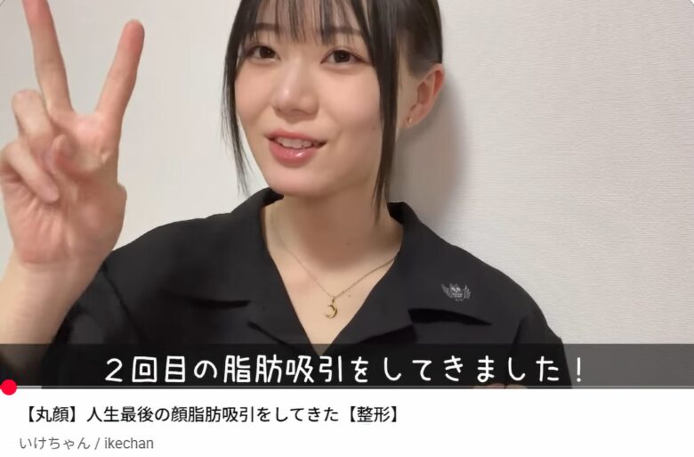 いけちゃんは整形で顔変わった?【顔比較】目元も顔輪郭もコンプレックス! | まるのトレンド